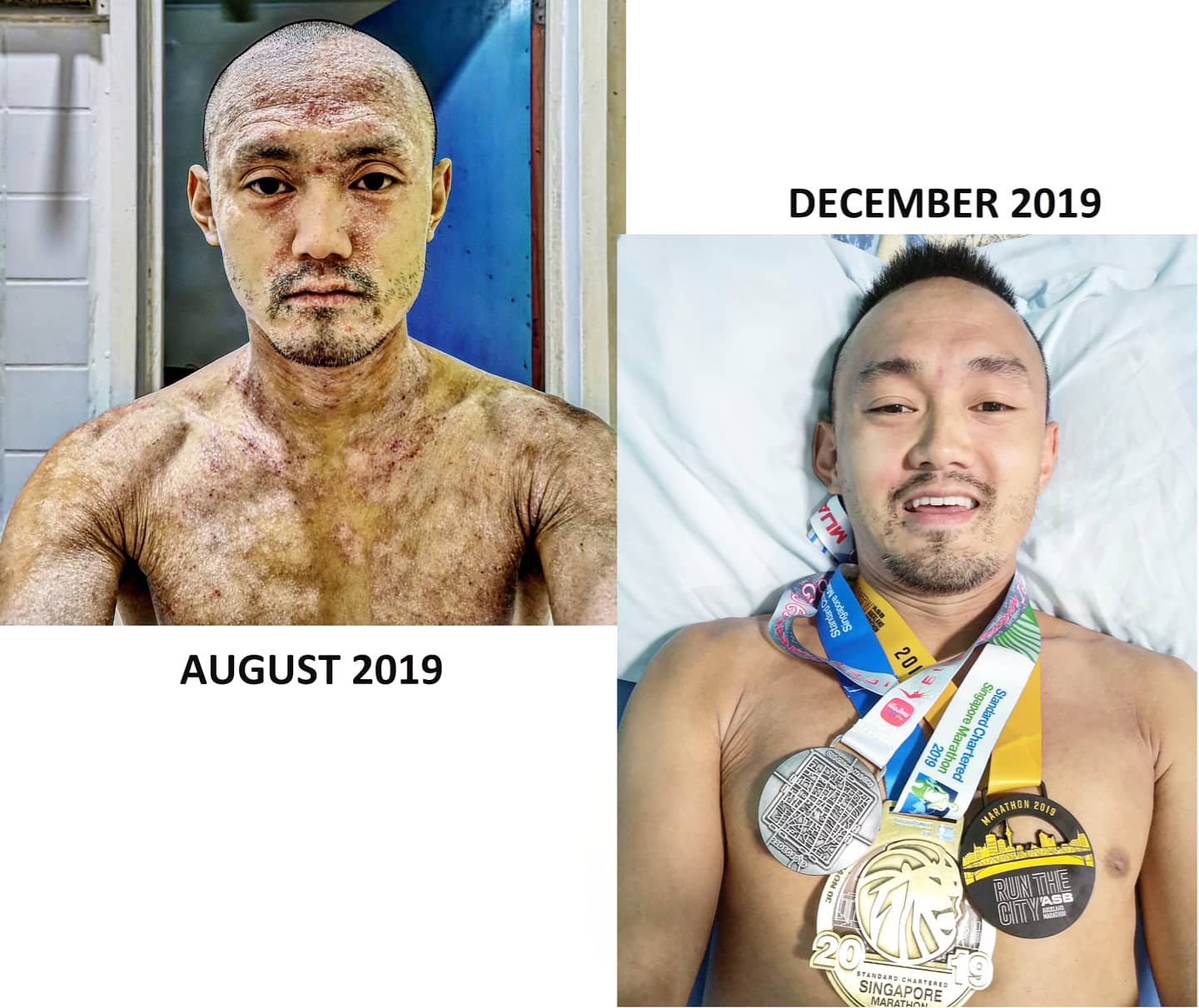 My Story - Healing TSW